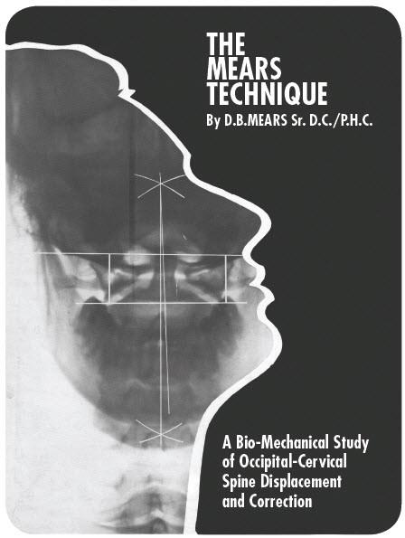 The Mears Technique – A Biomechanical Study of Occipital-Cervical ...